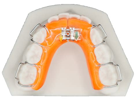 Transverse Lower Protec Dental