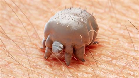 What Does The Dream Of Bugs Under Skin Symbolize In General