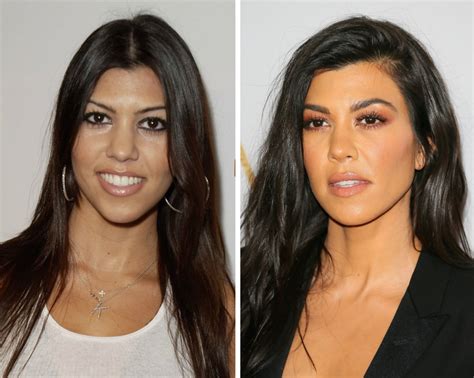 Kardashian Sisters Whos Gotten The Most Surgery