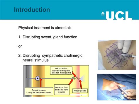 Hyperhidrosis And Retrodermal Axillary Curettage Ppt
