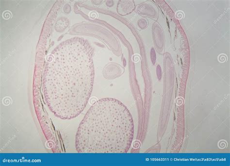 Parasitic Nematode Worm Ascaris Sp Under The Microscope Royalty Free