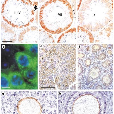 Testis Histology Genotypes Are As Described In The Legend To Fig 3 Download Scientific