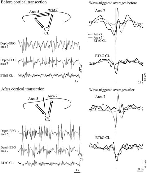 Spike Wave Complexes And Fast Components Of Cortically Generated