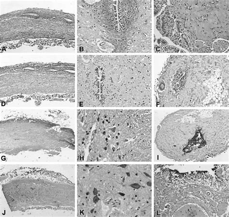Figure 3 From The Immunohistochemical Profile Of The Normal Conus