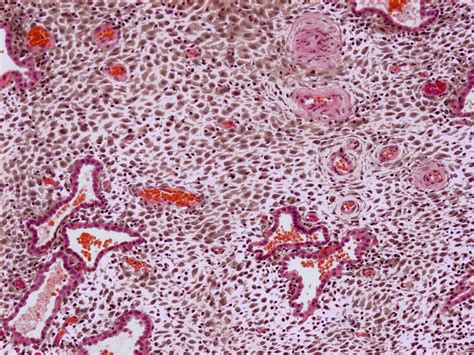 Placenta Light Micrograph Stock Image C0199297 Science Photo