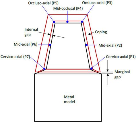 Schematic Presentation Of Marginal And Internal Gaps In Metal