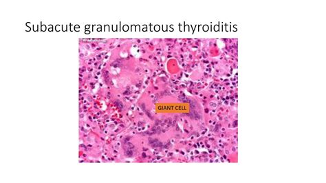 Ppt Endocrine Pathology Lab Materials Summary For Exam Prep