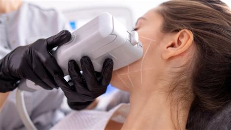 Hifu Treatment Bovolon Aesthetics