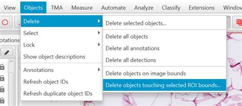 Cellpose Sam Qupath Extension Usage And Issues Image Sc Forum