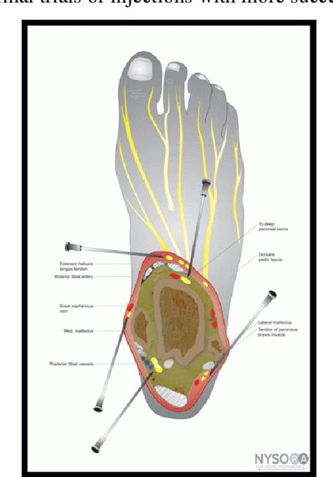 Saphenous Nerve Ankle