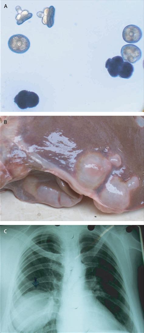 Prevention And Control Of Cystic Echinococcosis The Lancet Infectious