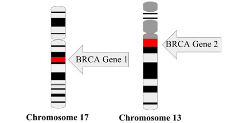 Inherited Brca Mutation Not Just A Female Problem Andrew Siegel