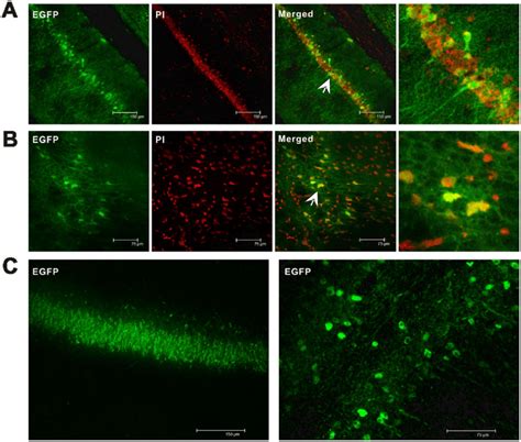 Egfp Expression Was Assessed In The Aav Control Brain Slice By