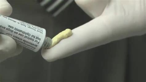 Topical Medication Administration