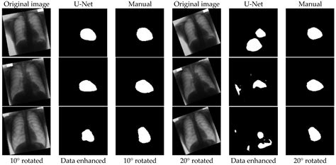 Applied Sciences Free Full Text A Segmentation Method Based On
