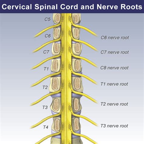 Lumbosacral Radiculitis Trial Exhibits Inc