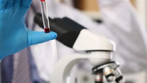 Fda იმ მსოფლიოში ყველაზე ძვირადღირებული წამალი დაამტკიცა რომლის ფასი 4 25 მილიონი დოლარია