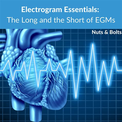 Electrogram Essentials The Long And The Short Of Egms Cha Ep Nerds Unite