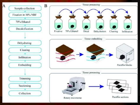 Tissue Processing Of Histopathologypptx First Aid Injuries