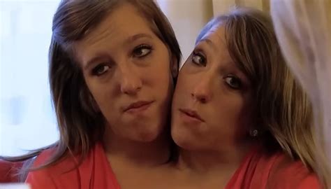 Dicephalus Conjoined Twin Abby Hensel Of “abby And Brittany” Is Married Bored Panda