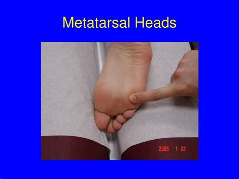 Ppt Foot Surface Anatomy Powerpoint Presentation Free Download Id