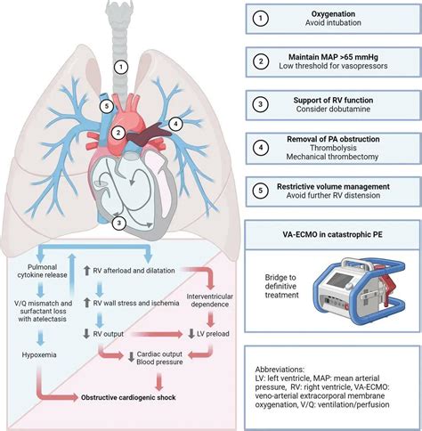 Medpic Acute Pulmonary Embolism Management Facebook