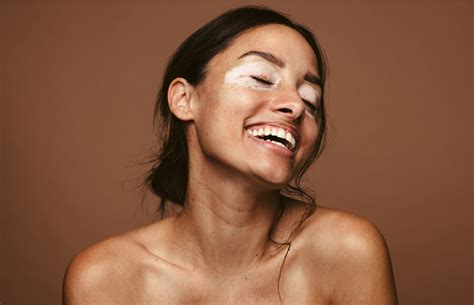 Red Light Therapy For Vitiligo Hooga