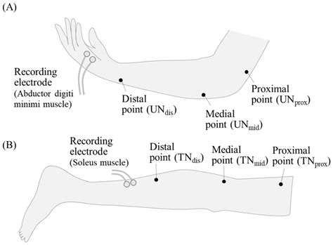 Sex Specific Differences In Peripheral Nerve Properties A Comparative
