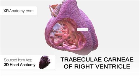 Types Of Trabeculae Carneae Trabeculae Carneae In The Heart Sem
