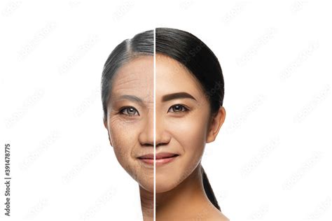 Comparison Portrait Of Beautiful Asian Woman With Problem And Clean