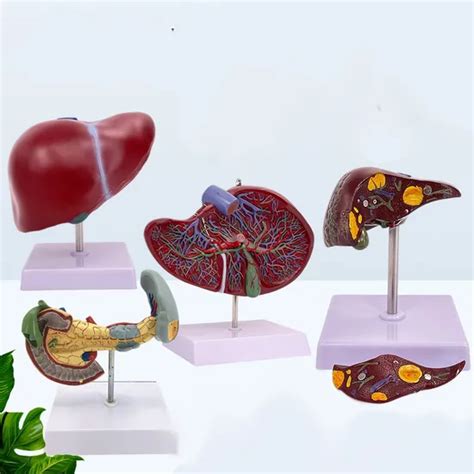 Liver Anatomical Model Hepatobiliary Pancreas Spleen Duodenal Relief