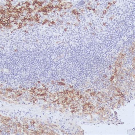 Cd138 Syndecan 1 Antibody Immunohistochemistry Fardadazma