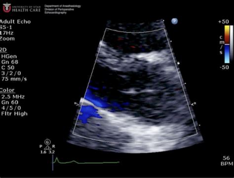 Identifying Normal Tee Structures Flashcards Quizlet