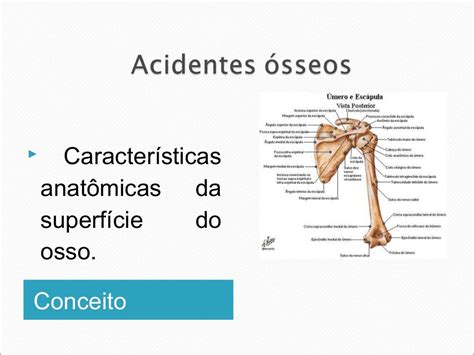 O Que Sao Acidentes Osseos Retoedu