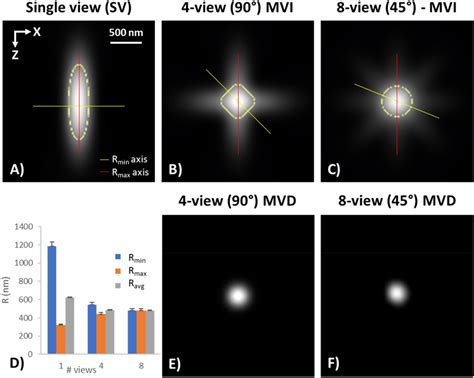 Multiview Resolution Ac Cross Section Of The Psf Of A Single View