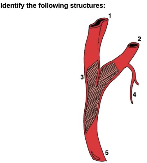 Ch 65 — Vascular Surgery 2 Diagram Quizlet