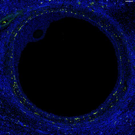 Nanostring Technologies Inc On Linkedin Saturdayslideshow Spatialbiology Tissue