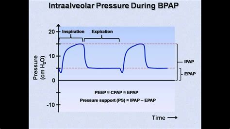 Ventilación Ipap La Casa Del Ventilador