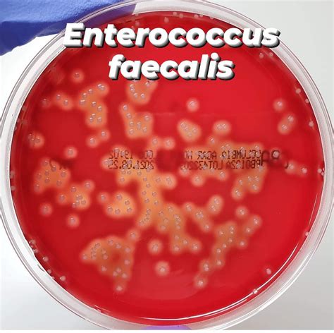 Enterococcus Faecalis Microbiology Laboratory Turkey