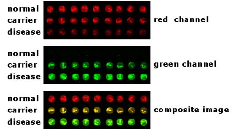Arrayit Corporation Aryc Products Dna Microarrays Microarrays