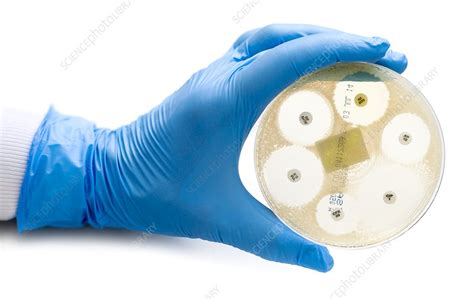 Antibiotic Sensitivity Test Stock Image C0232949 Science Photo Library