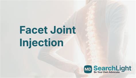 Facet Joint Injection Md Searchlight