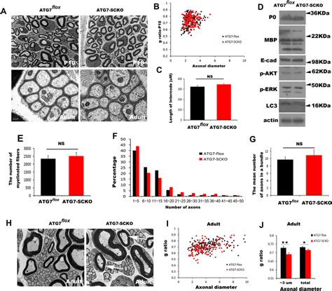 myelination profiles of sciatic nerves in atg7 scko mice a