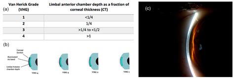 Anterior Chamber Cell Count Chart Gdydw