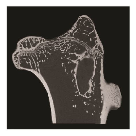Representative Micro Ct Images From Each Group The Trabecular Bone In