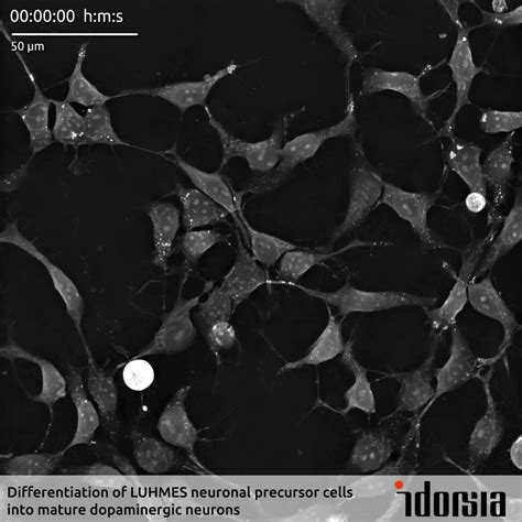 Luhmes Neuronal Precursor Cells Differenting Into Mature Dopaminergic