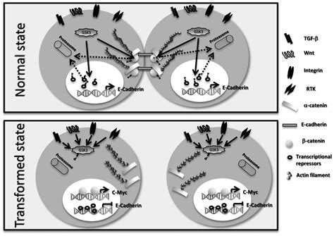 Lipogenesis In Cancer Progression Review