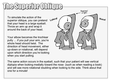 Superior Oblique Muscle Action