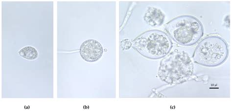 Trichomonas In Urine Sediment