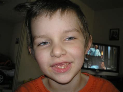 Missing Teeth Messed Up Mama Flickr